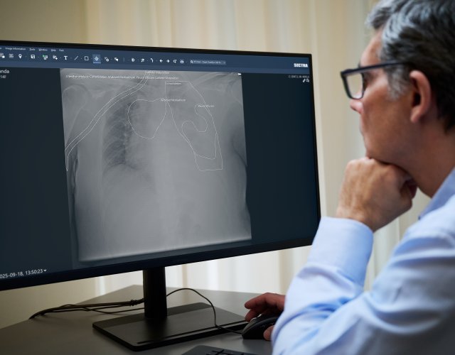Sectra | PACS / VNA mit integrierter Befundung - RadMag - Online ...
