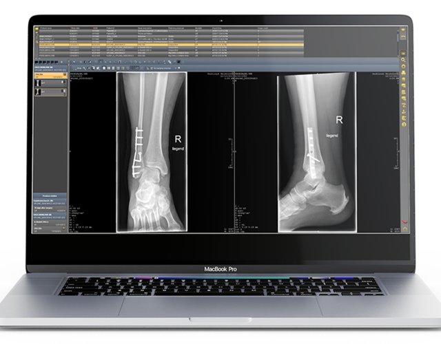 NEXUS / CHILI - RadMag - Online-Journal für die Radiologie @ RadMag ...