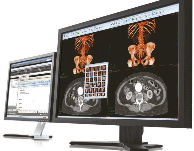 Sectra | PACS / VNA mit integrierter Befundung - RadMag - Online ...