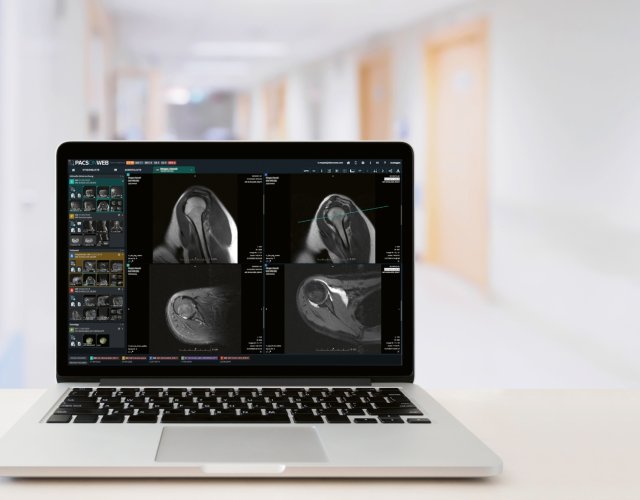 Siemens Healthineers | Syngo Carbon - RadMag - Online-Journal für die ...