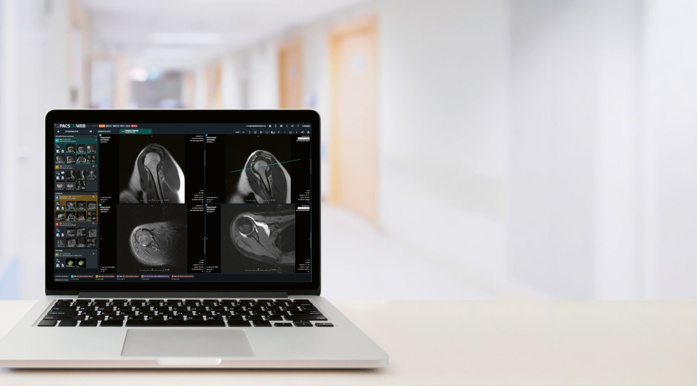 DeepUnity PACSonWEB - RadMag - Online-Journal für die Radiologie @ RadMag - Online-Journal für ...