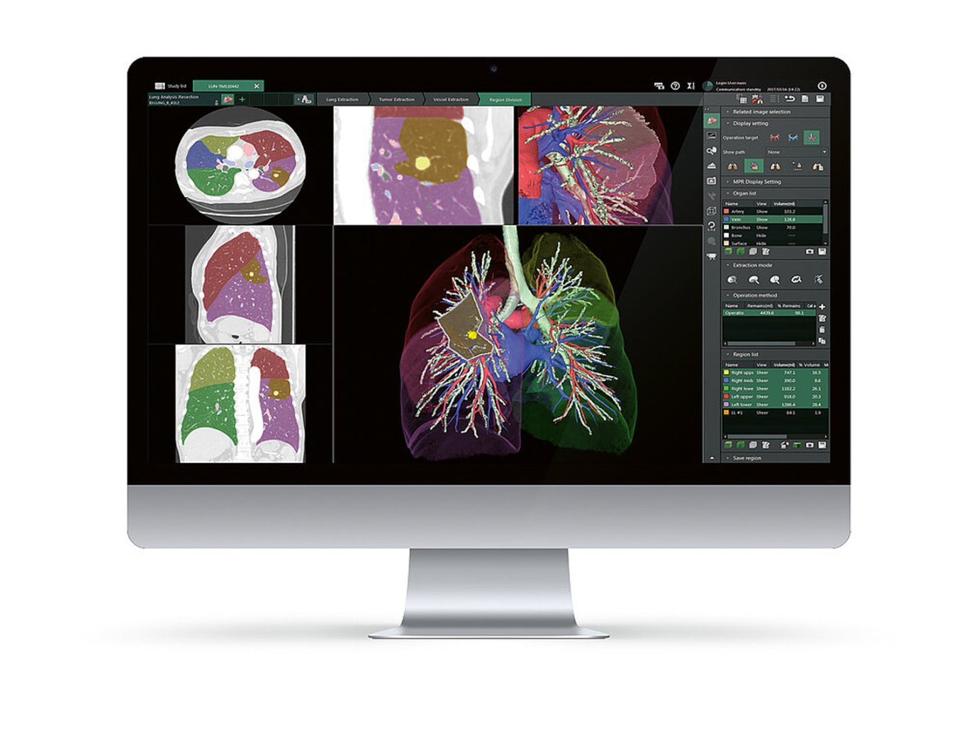 Fujifilm | Synapse 3D - RadMag - Online-Journal für die Radiologie ...