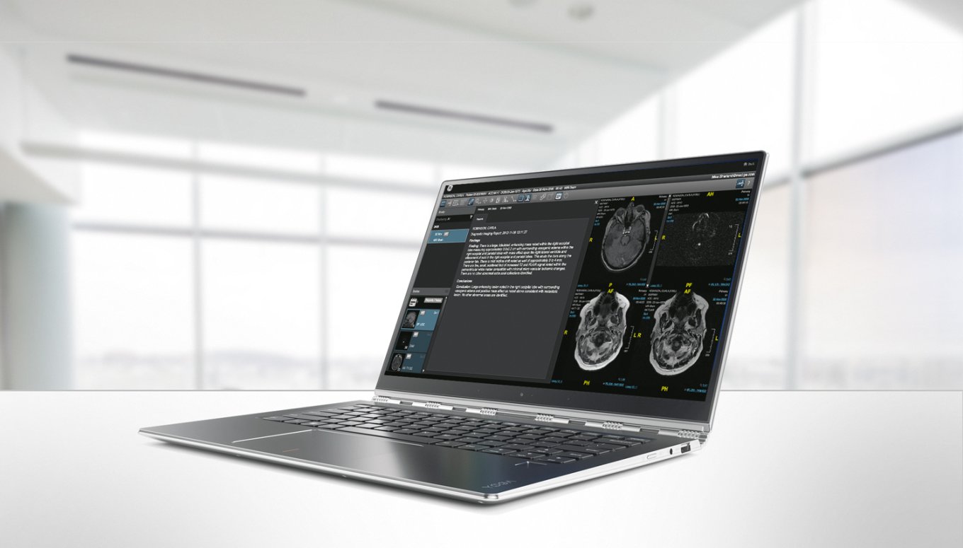 GE HealthCare | Centricity Universal Viewer Zero Footpr. - RadMag ...