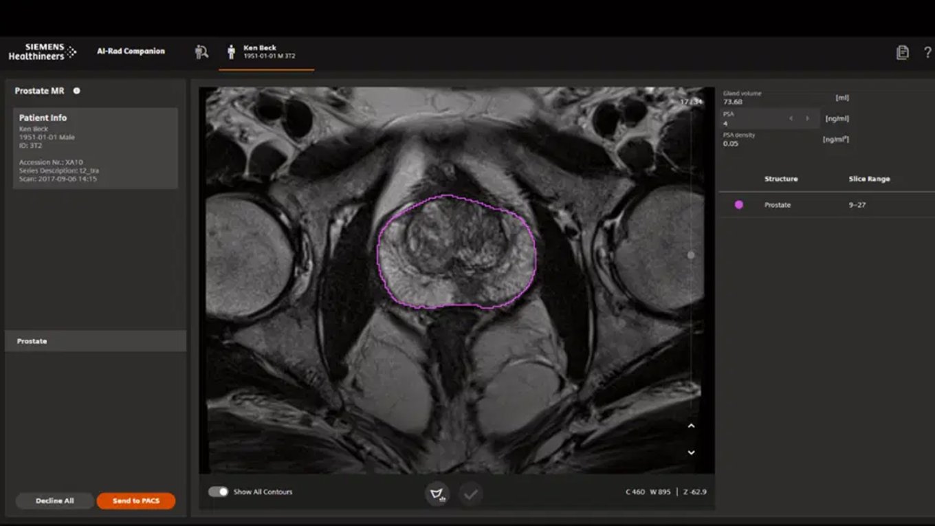Siemens Healthineers | AI-Rad Companion Prostate MR - RadMag - Online ...