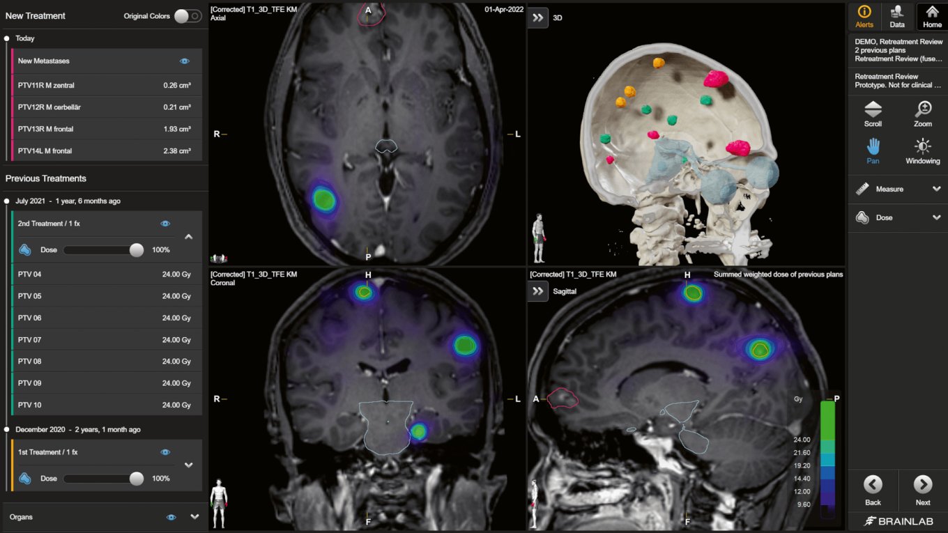 Präzise, individuell, schonend - RadMag - Online-Journal für die ...