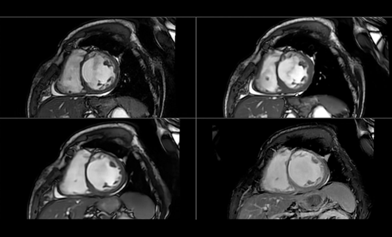 GE HealthCare | Sonic DL - RadMag - Online-Journal für die Radiologie ...