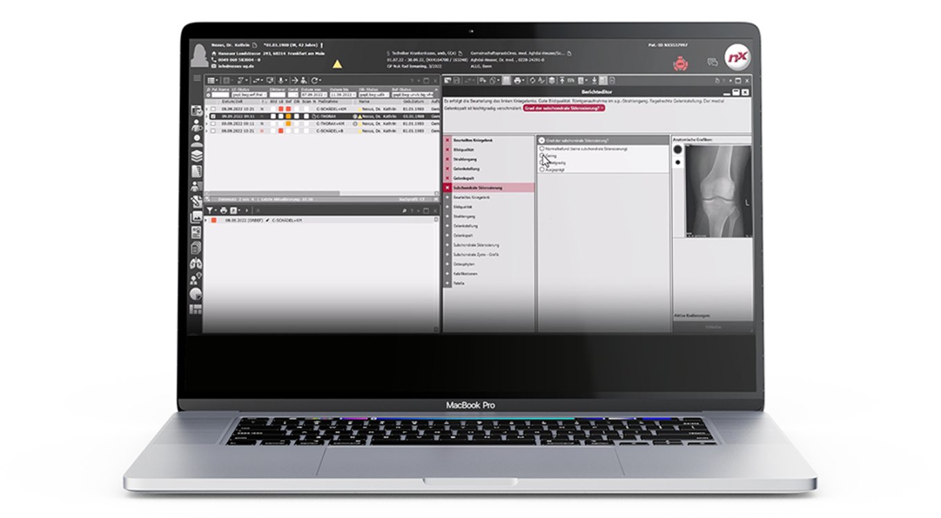 NEXUS AG | NEXUS / Advanced ReportingVue - RadMag - Online-Journal für ...